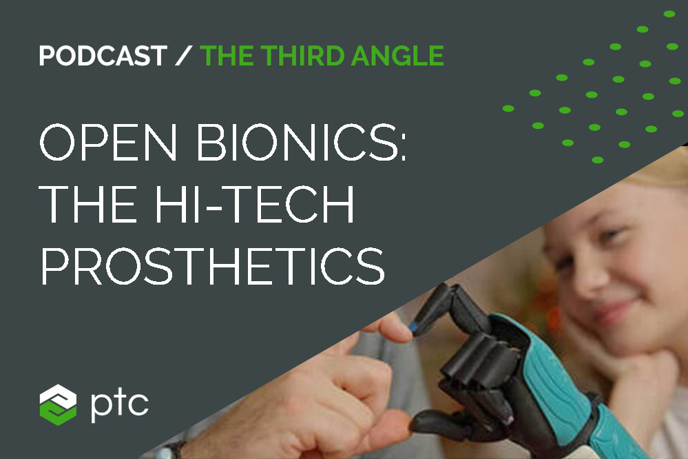 55 - Open Bionics: The Hi-Tech Prosthetics Turning... - PTC Community